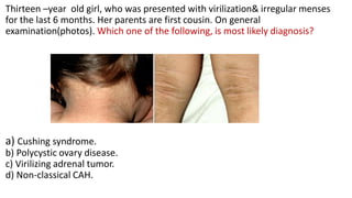 Pediatric endocrinology review part 4 | PPT