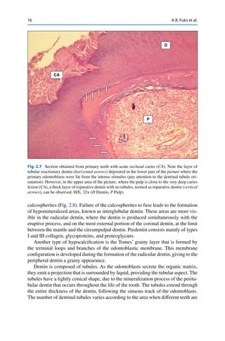 Pediatric Endodontics_ Current Concepts in Pulp Therapy for Primary and ...