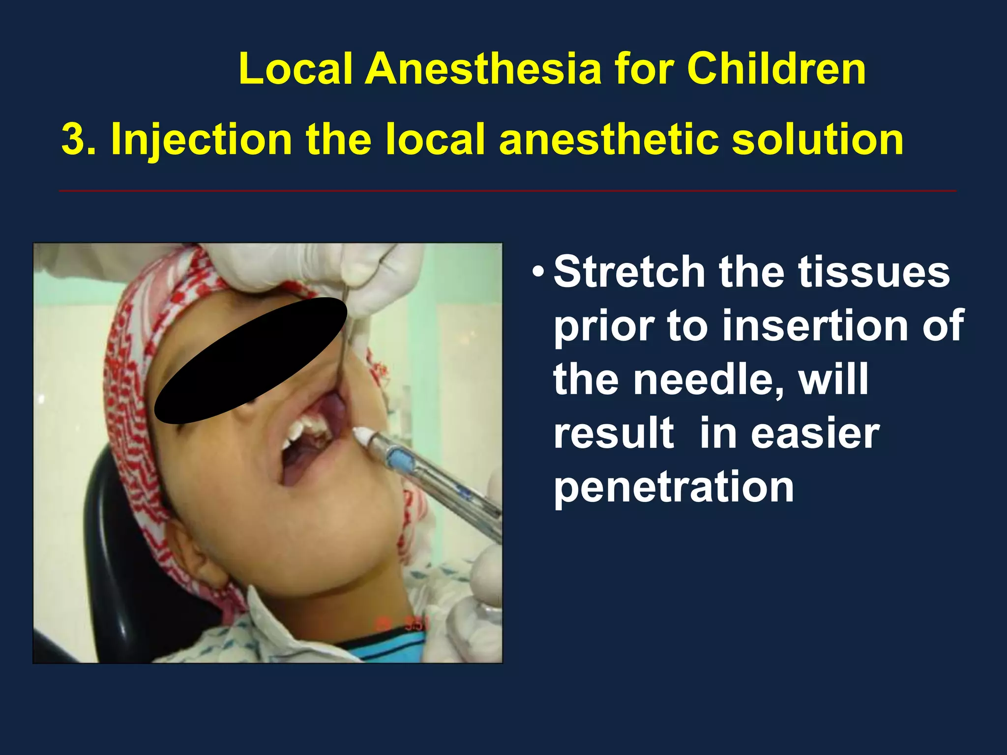 Pediatric Exodontia.pptx