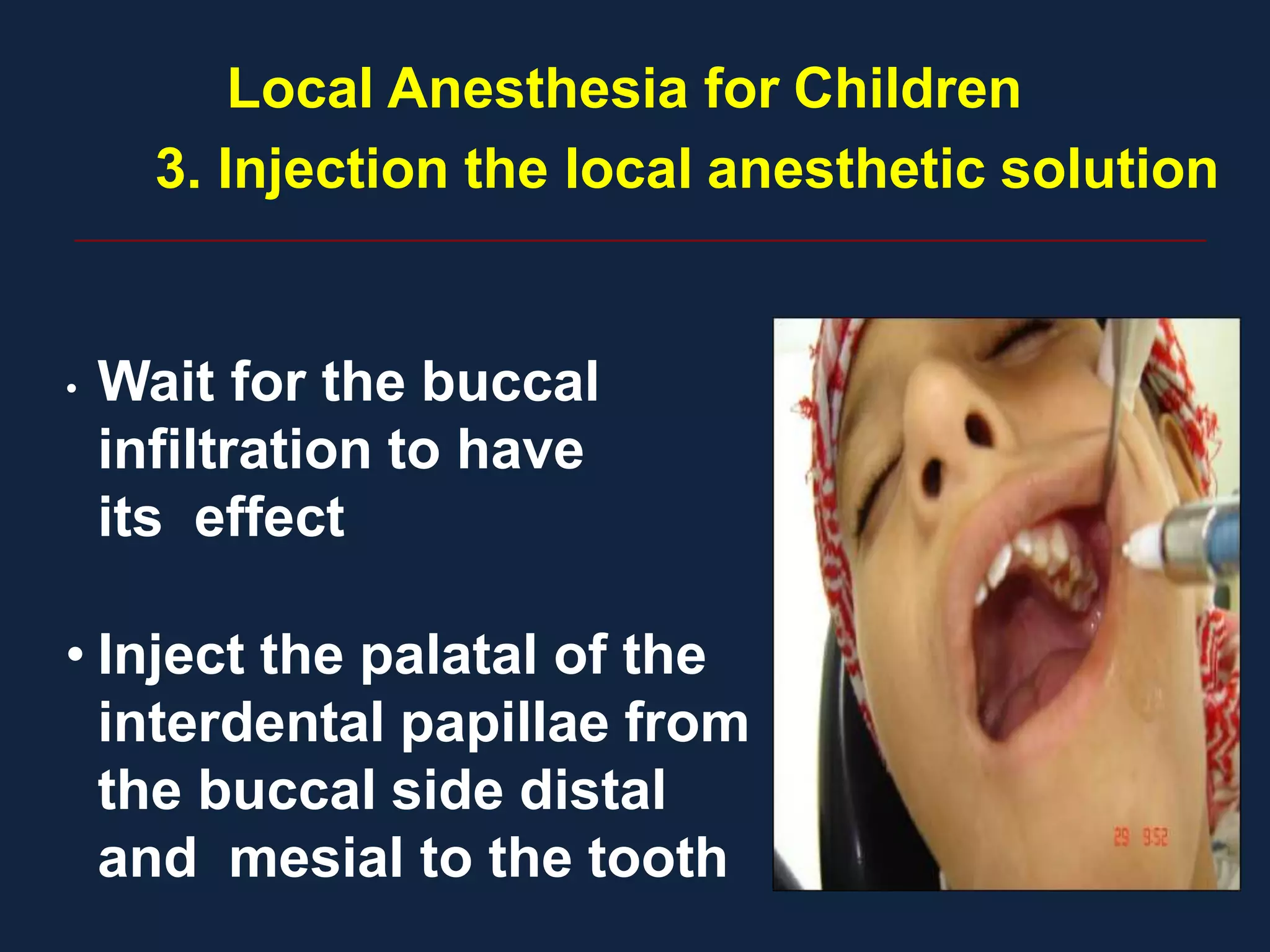 Pediatric Exodontia.pptx