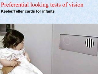 Pediatric eye and vision | PPT