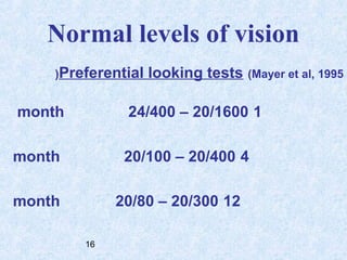 Pediatric eye and vision | PPT