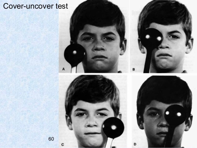 Pediatric eye and vision
