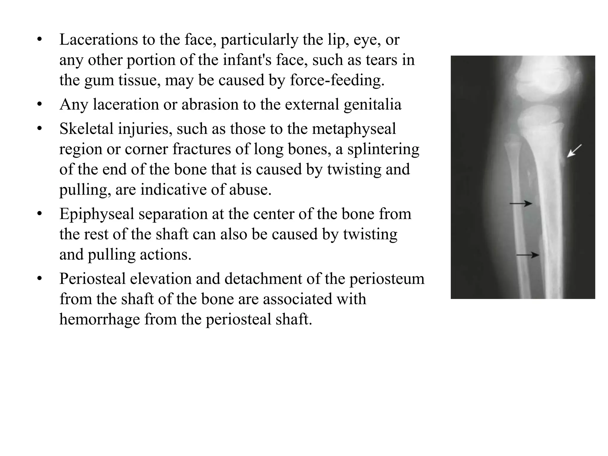 Pediatric facial injuries | PPTX