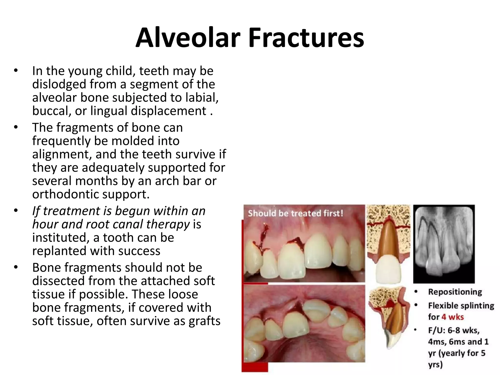Pediatric facial injuries | PPTX