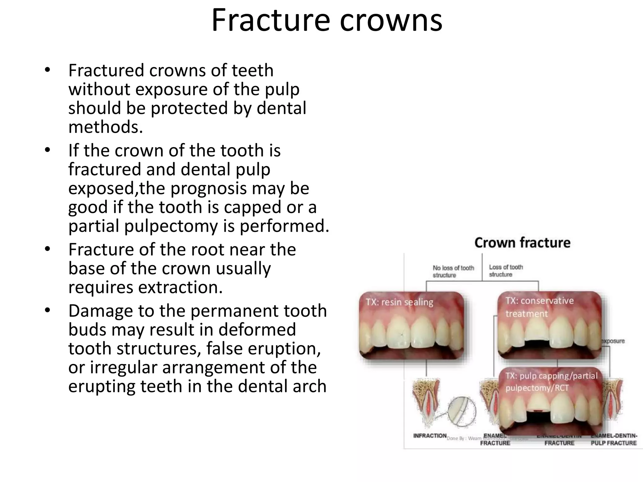 Pediatric facial injuries | PPTX