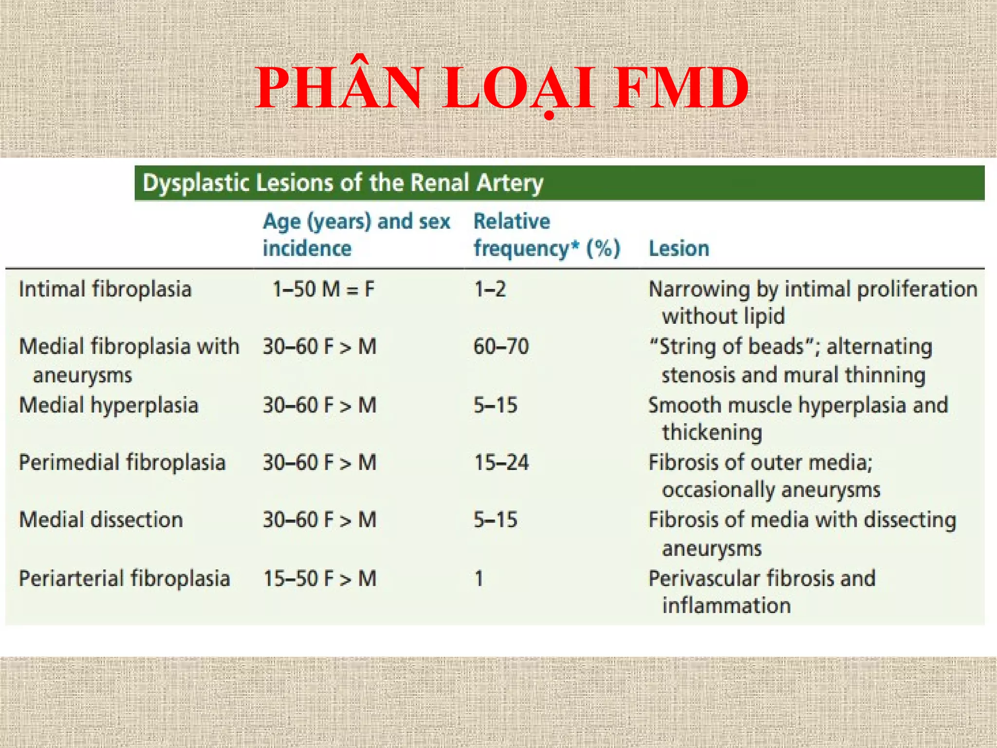 Pediatric fibromuscular dysplasia of renal arteries | PPT