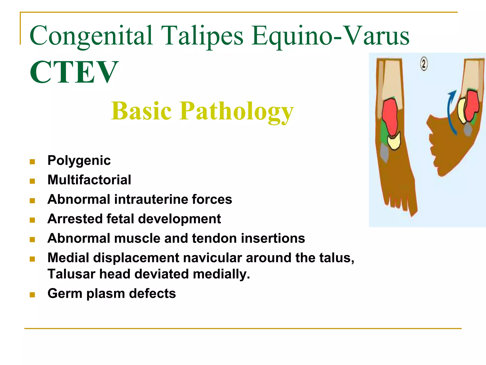 Pediatric foot deformities | PPT