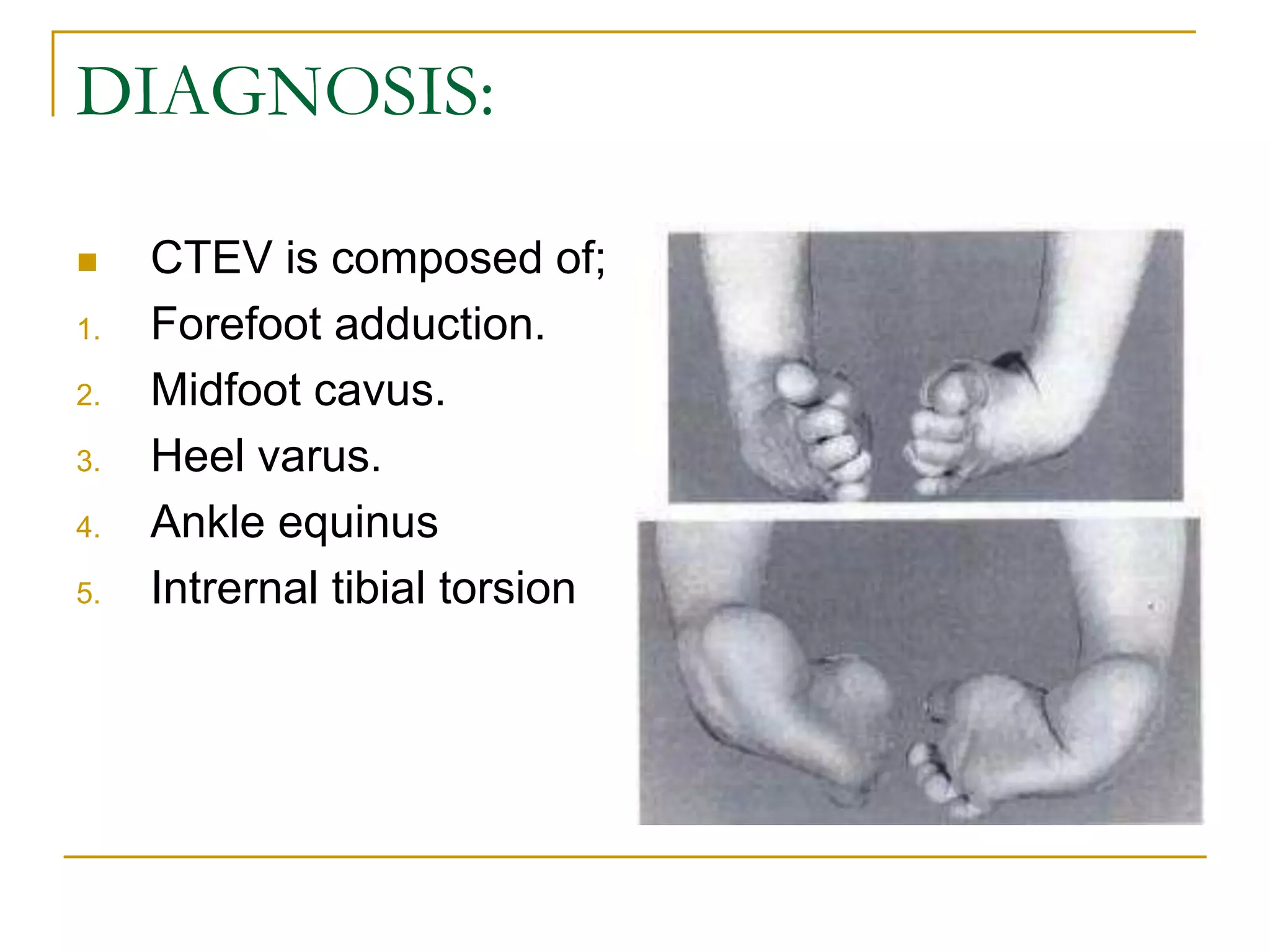 Pediatric foot deformities | PPT