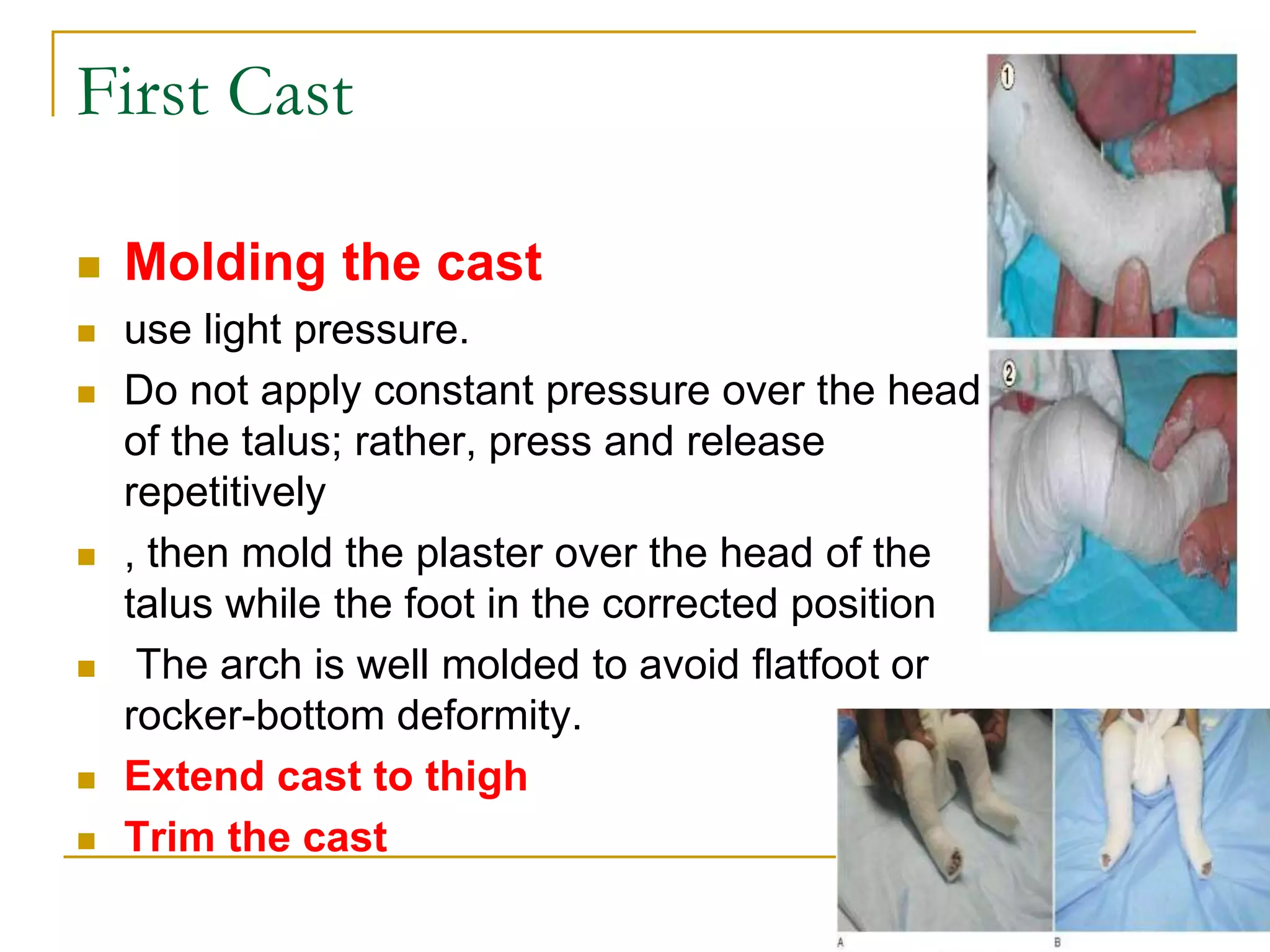 Pediatric foot deformities | PPT