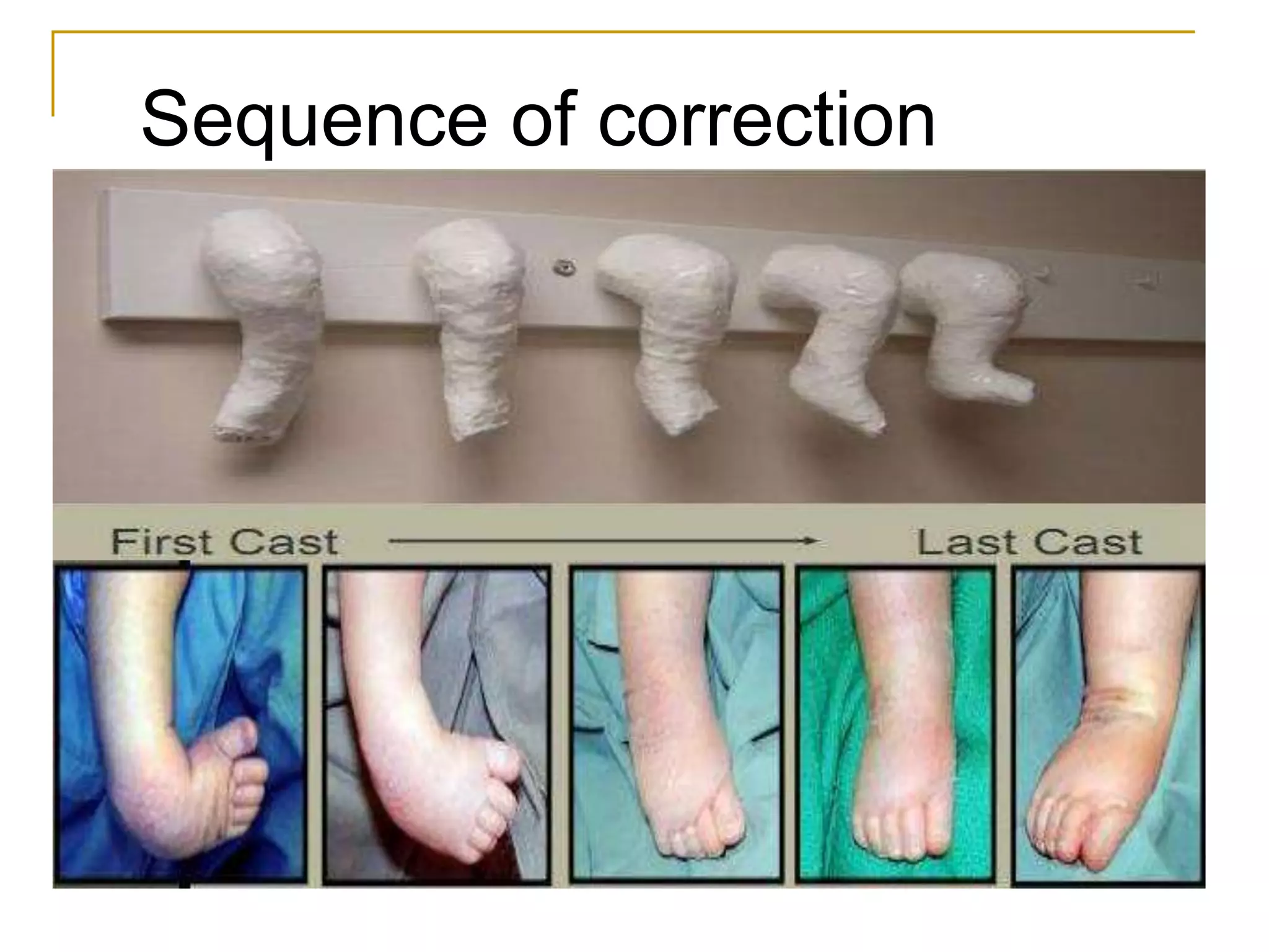 Pediatric foot deformities | PPT