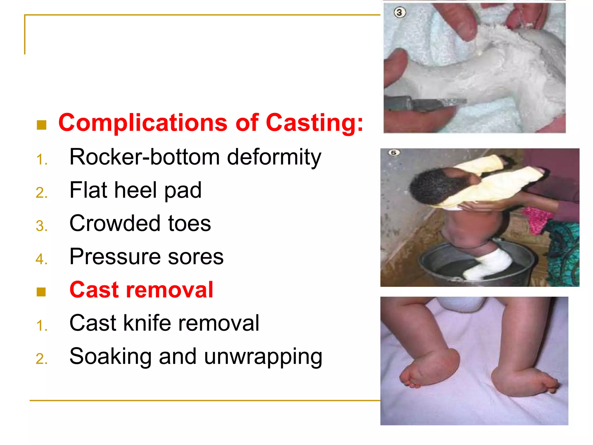Pediatric foot deformities | PPT