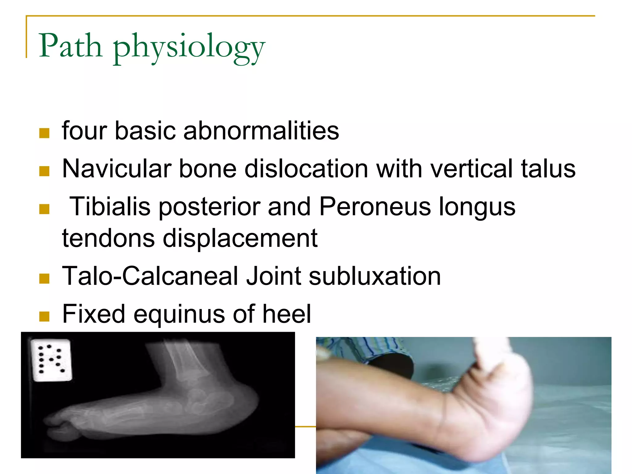 Pediatric foot deformities | PPT