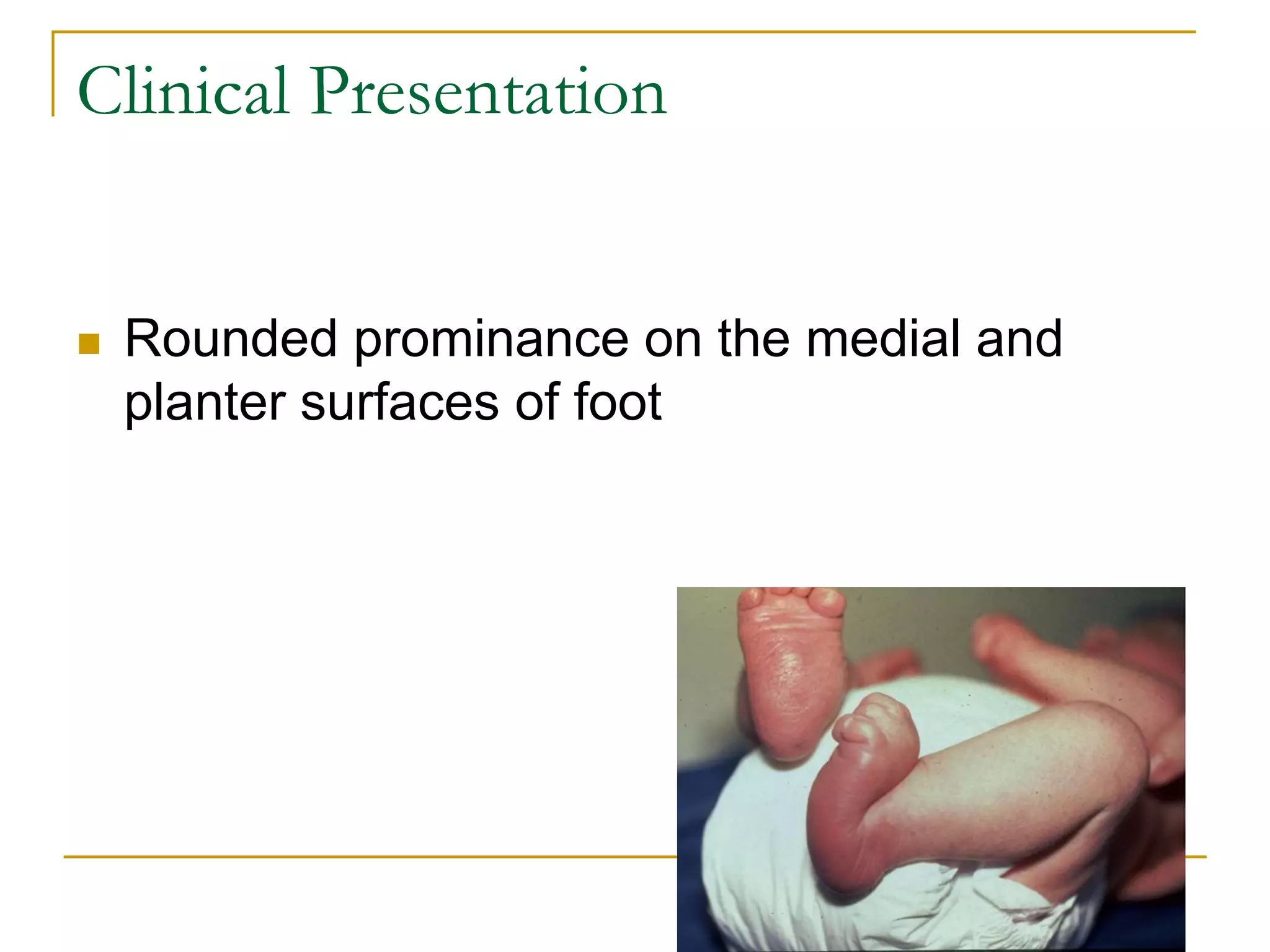 Pediatric foot deformities | PPT