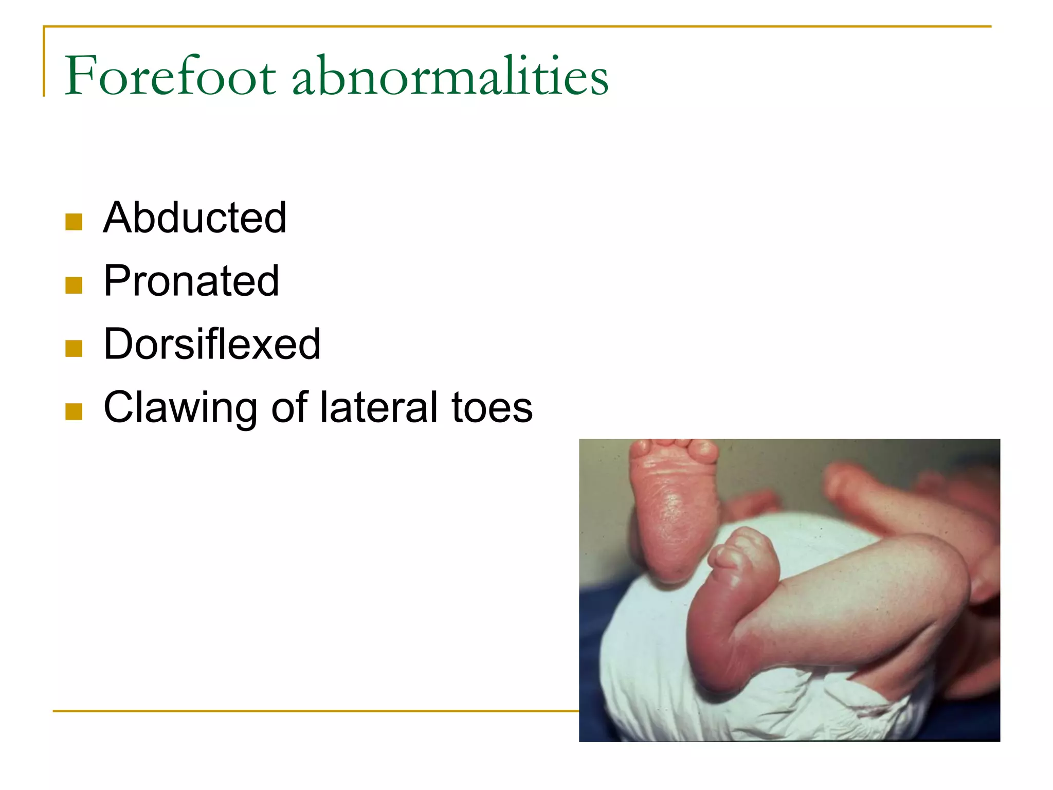 Pediatric foot deformities | PPT