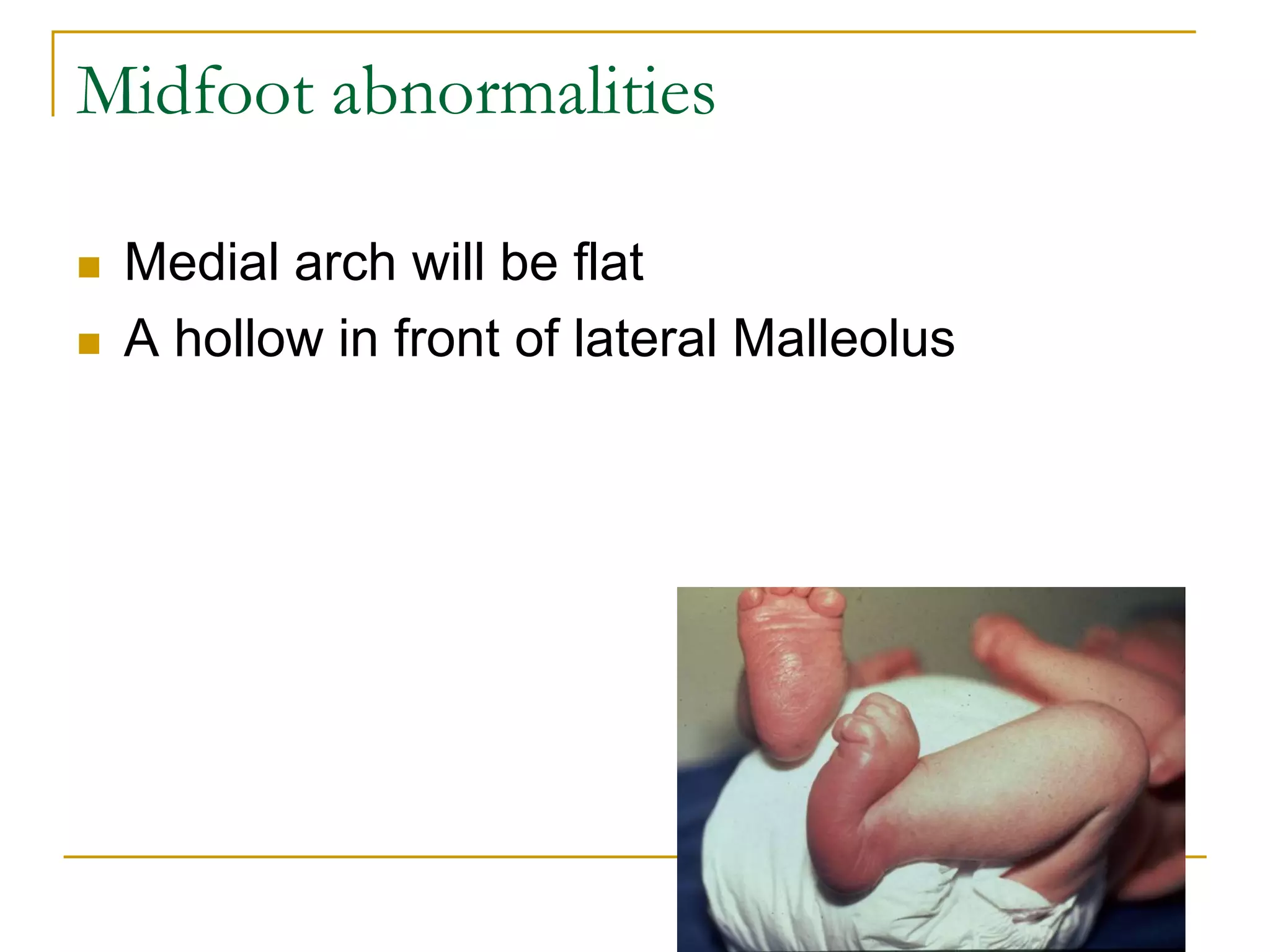 Pediatric foot deformities | PPT