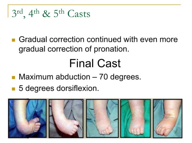 Pediatric foot deformities | PPT | Death, Injury, or Military Conflict ...