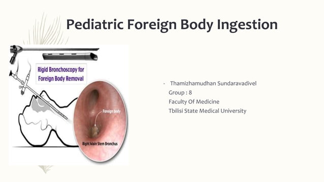 Pediatric foreign body ingestion | PPT