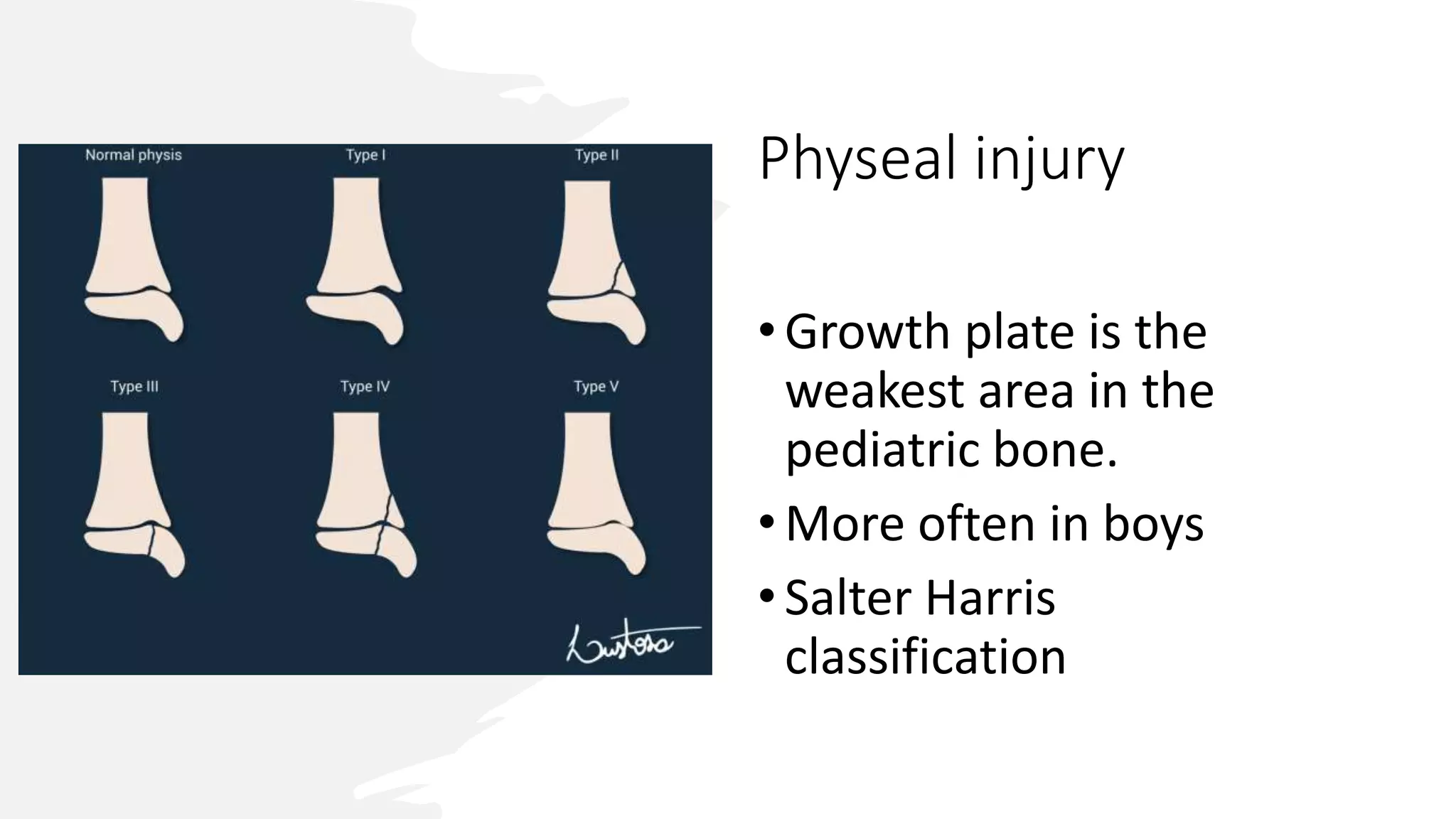 Pediatric Fractures.pptx