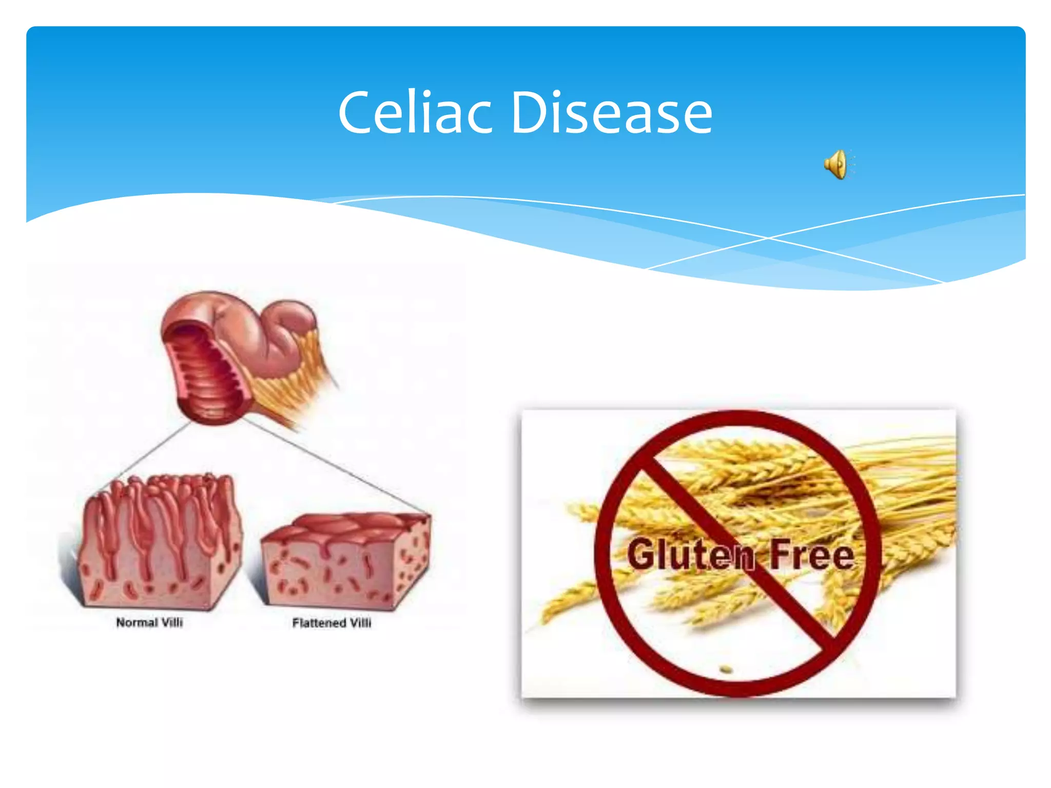 Pediatric gastrointestinal disorders | PPTX