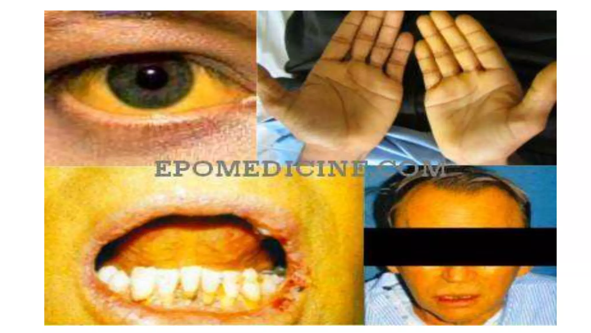 Pediatric git examination | PPTX