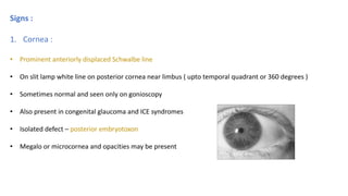 Pediatric glaucomas | PDF