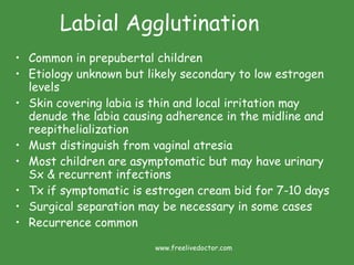 Pediatric gynecology | PPT