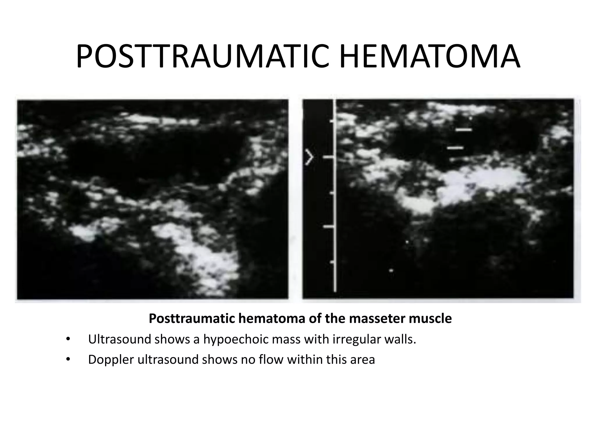 Pediatric head and neck masses | PPTX