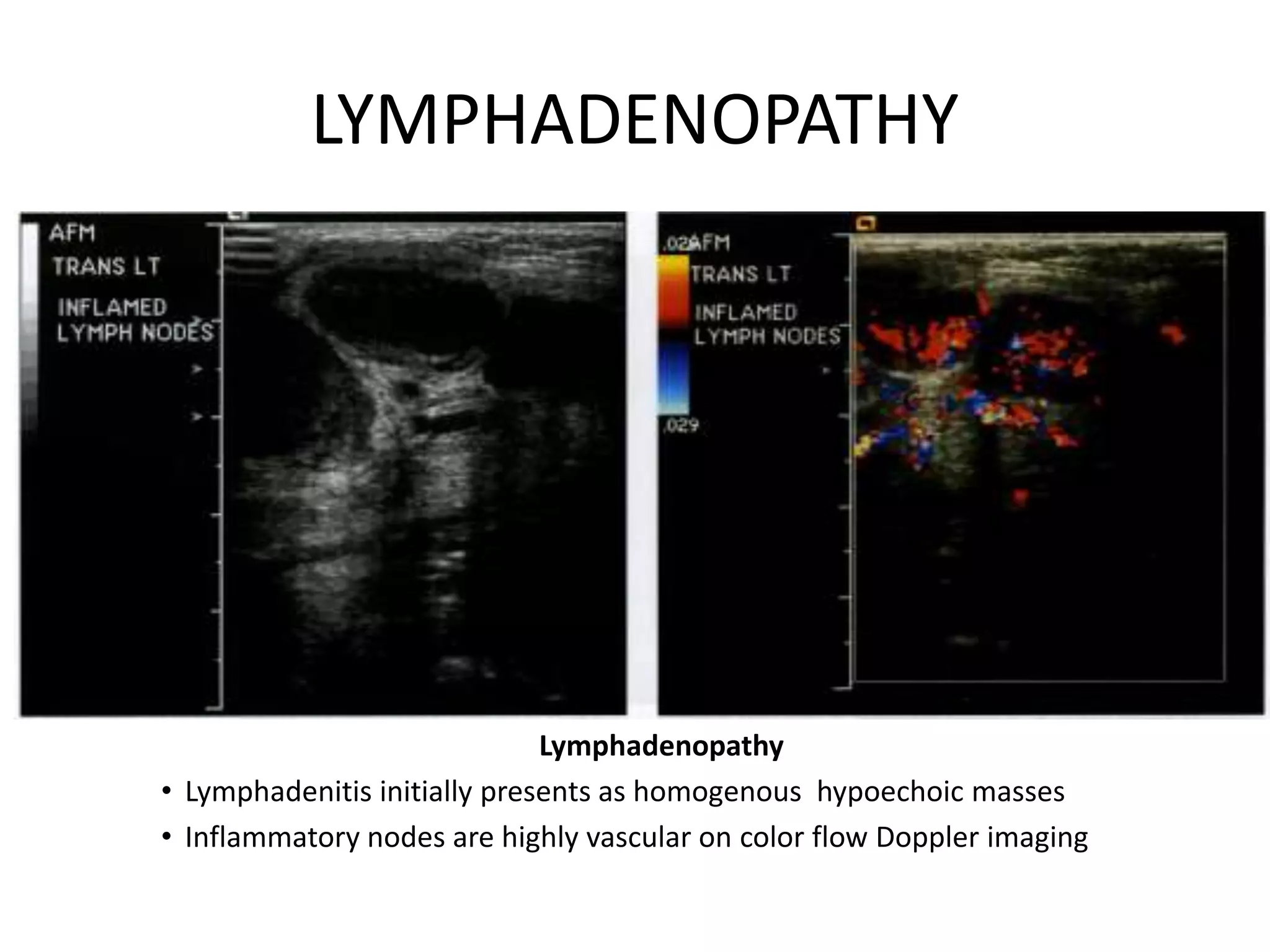 Pediatric head and neck masses | PPTX