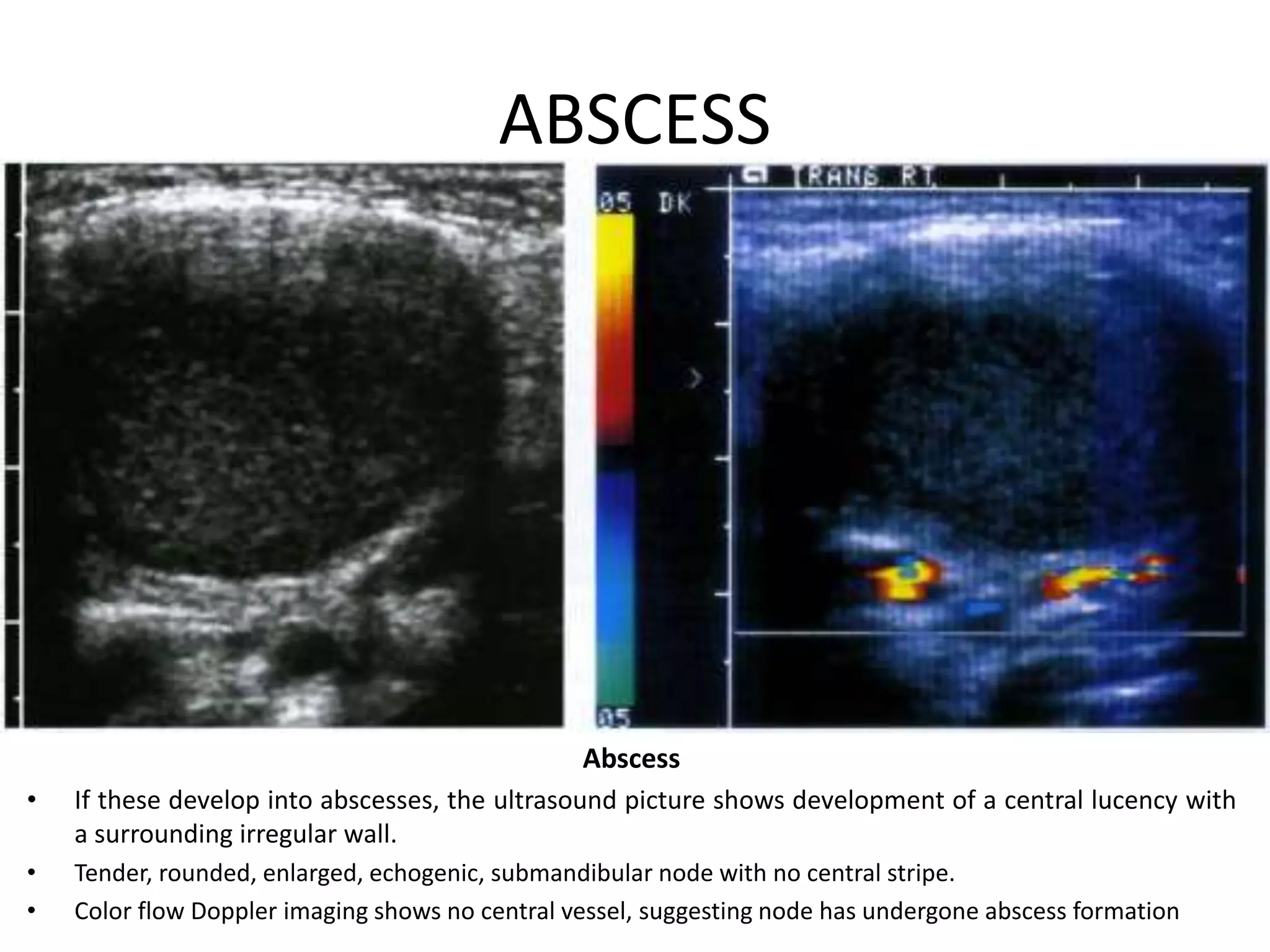 Pediatric head and neck masses | PPTX