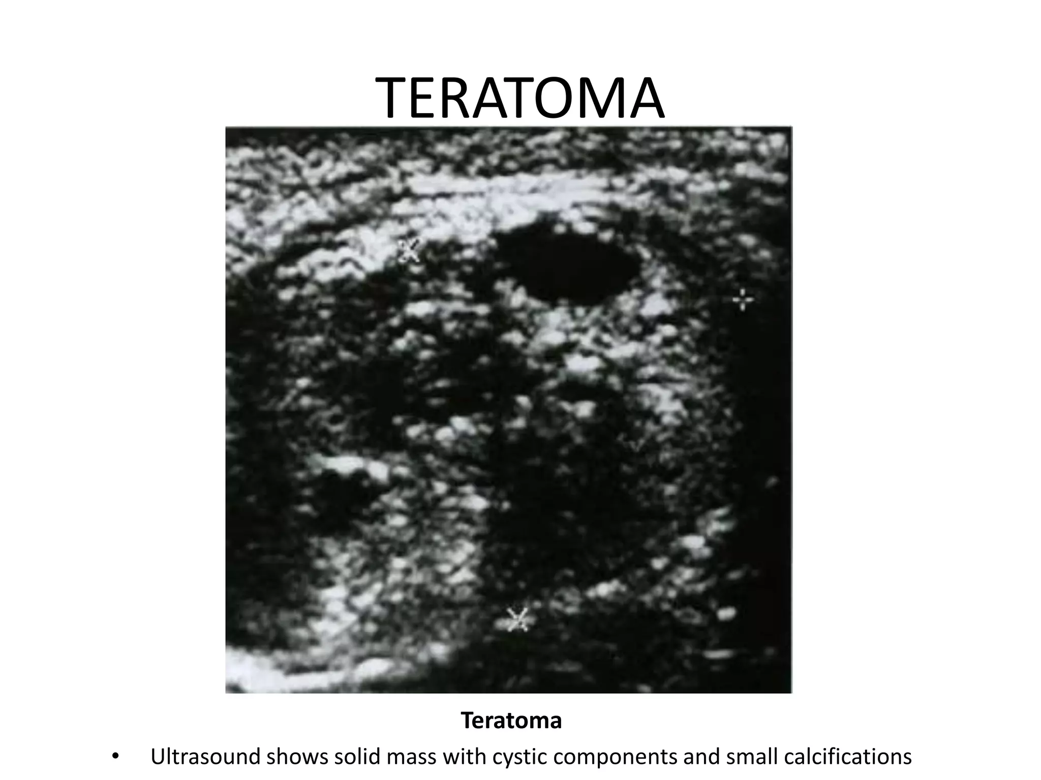Pediatric head and neck masses | PPTX
