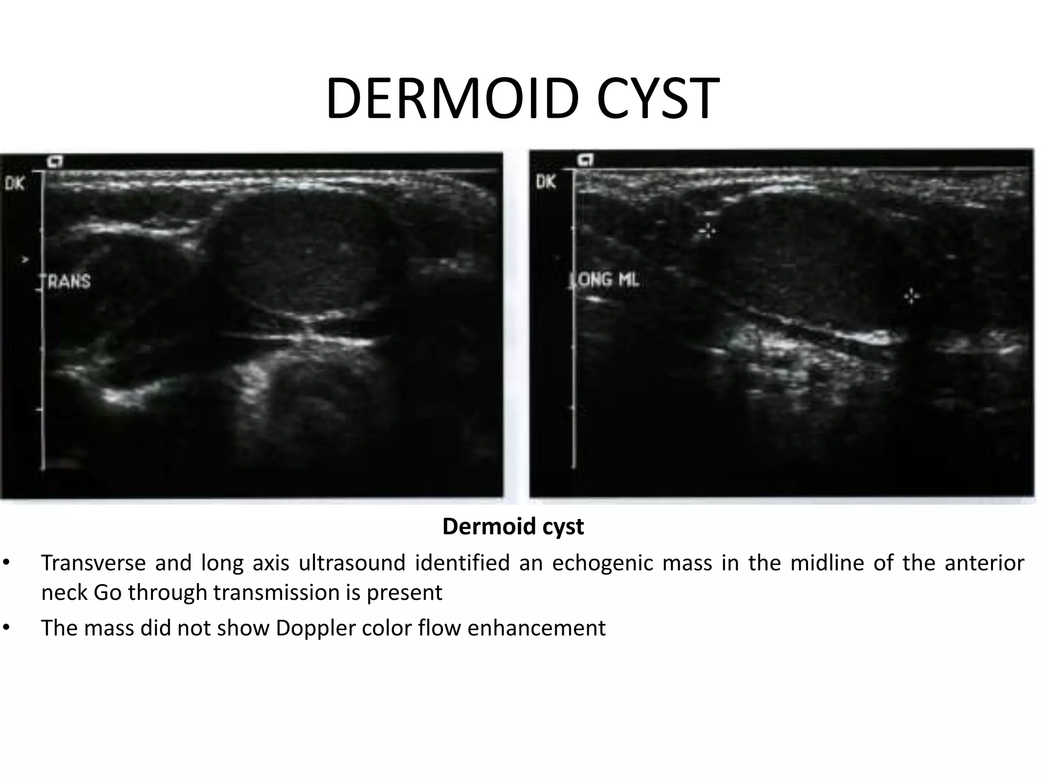 Pediatric head and neck masses | PPTX