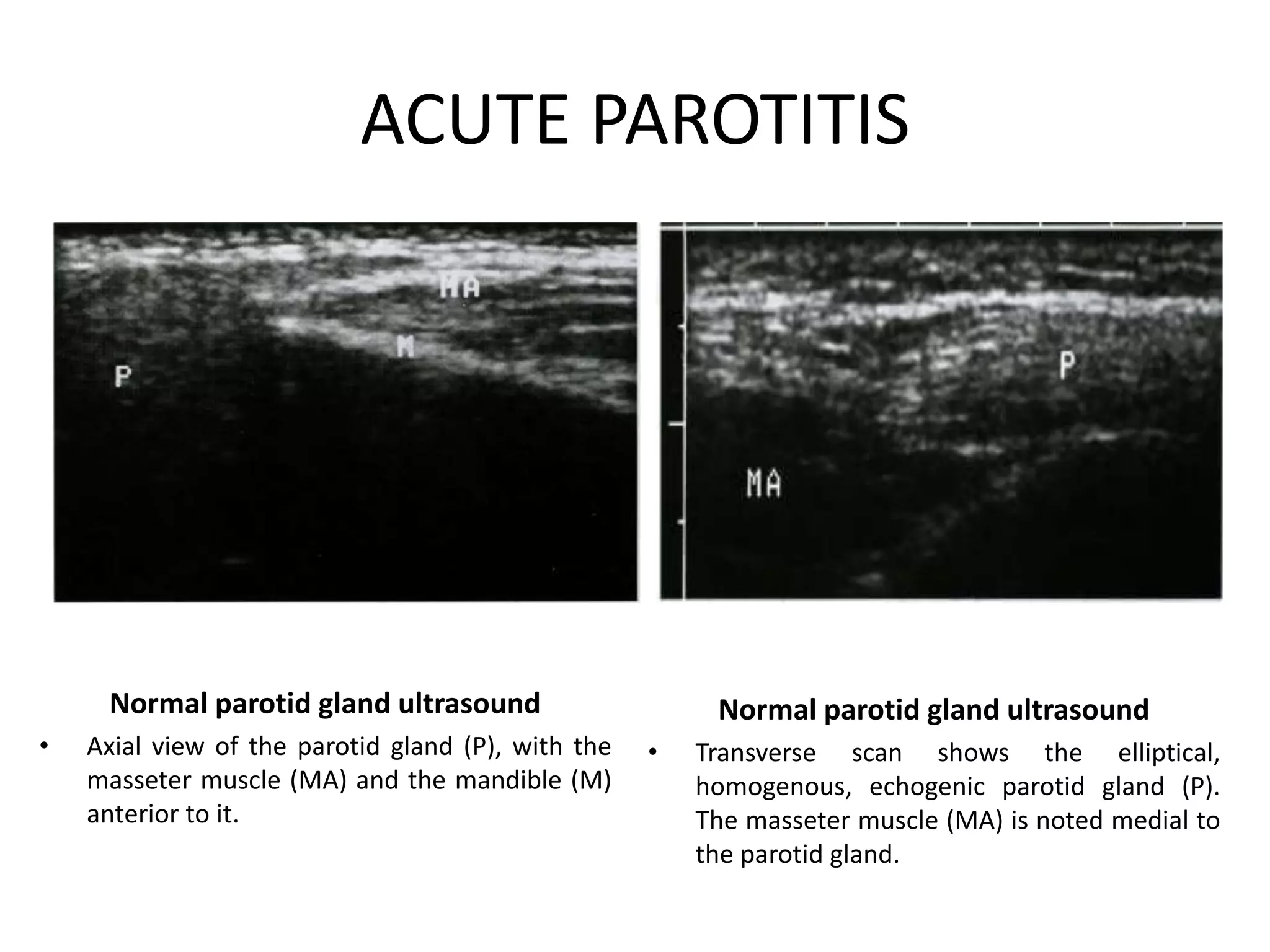 Pediatric head and neck masses | PPTX