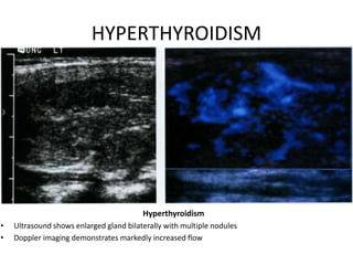 Pediatric head and neck masses | PPTX