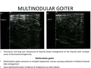 Pediatric head and neck masses | PPTX