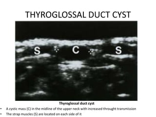Pediatric head and neck masses | PPTX