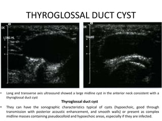 Pediatric head and neck masses | PPTX