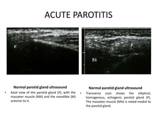 Pediatric head and neck masses | PPTX