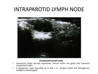 Pediatric head and neck masses | PPTX