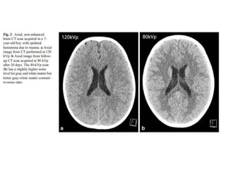 Pediatric head CT | PPT