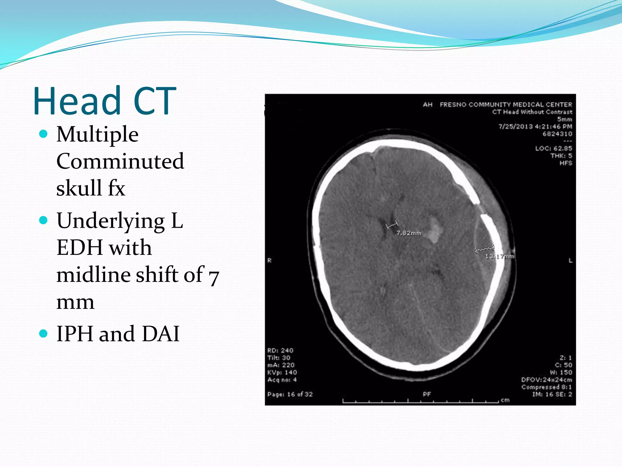 Pediatric head injury public | PPTX