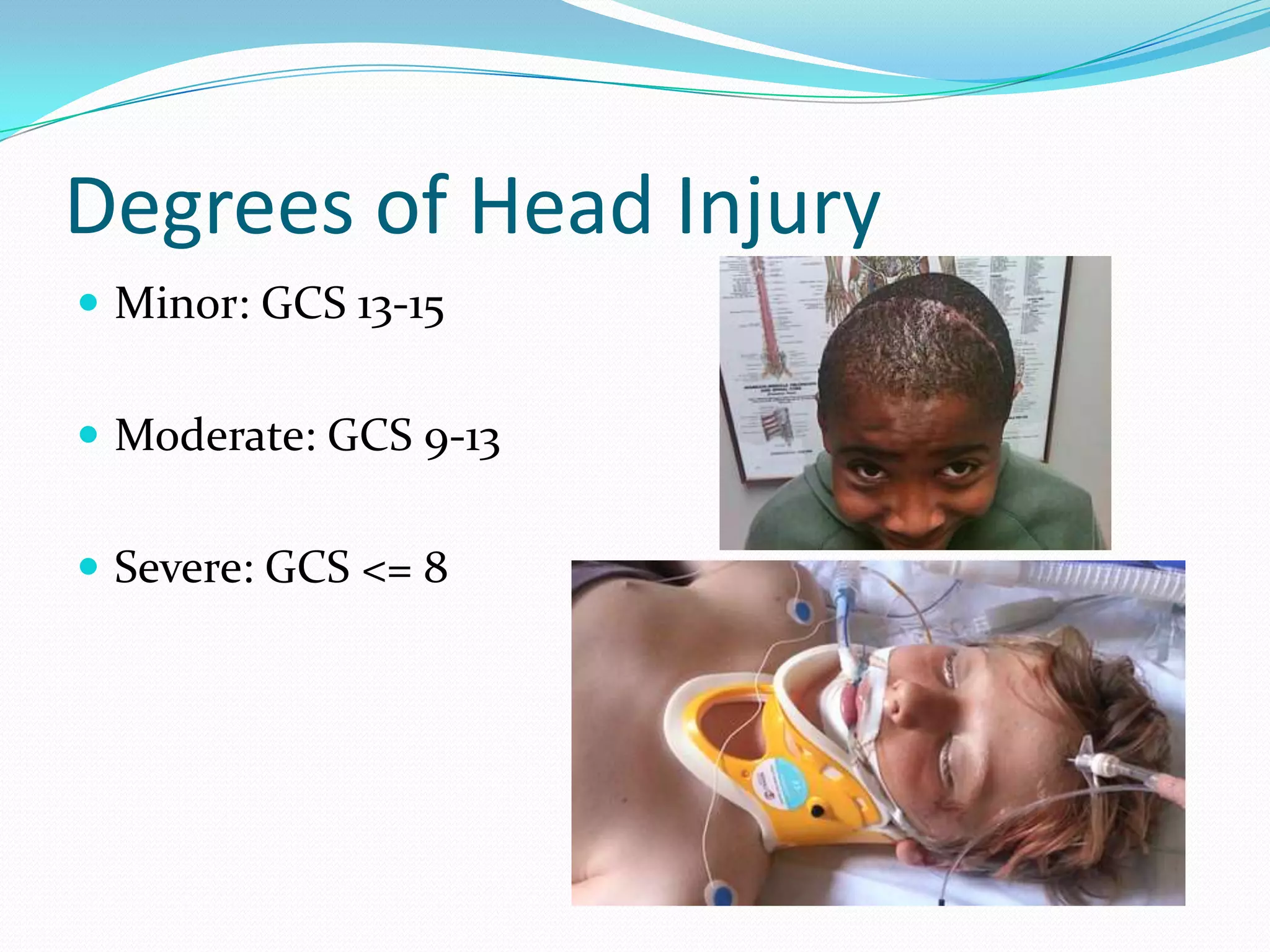 Pediatric head injury public | PPTX