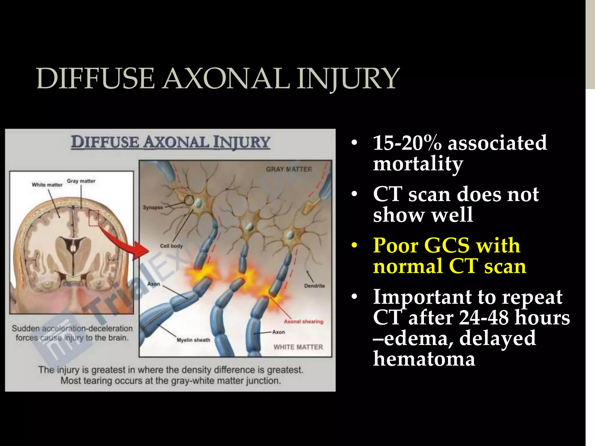 Pediatric Head Trauma | PPTX