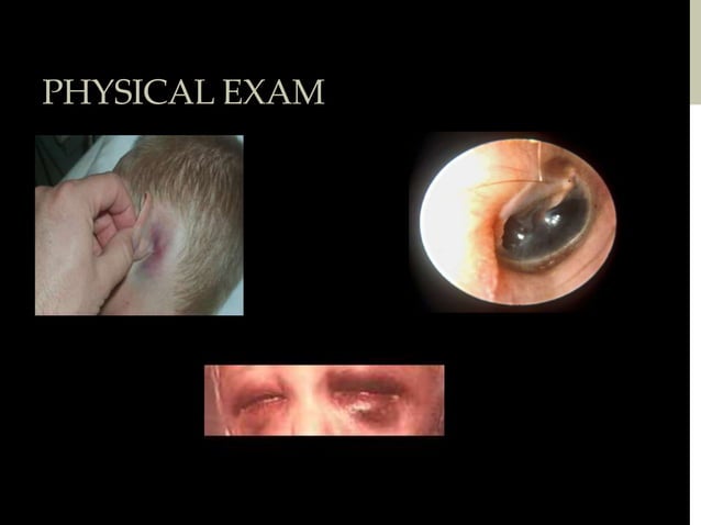 Pediatric Head Trauma | PPTX | First Aid | Injuries