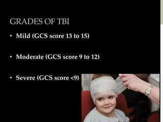 Pediatric Head Trauma | PPTX