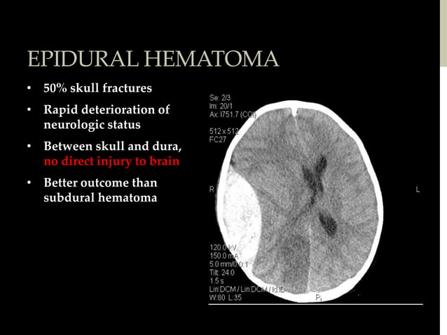 Pediatric Head Trauma | PPT