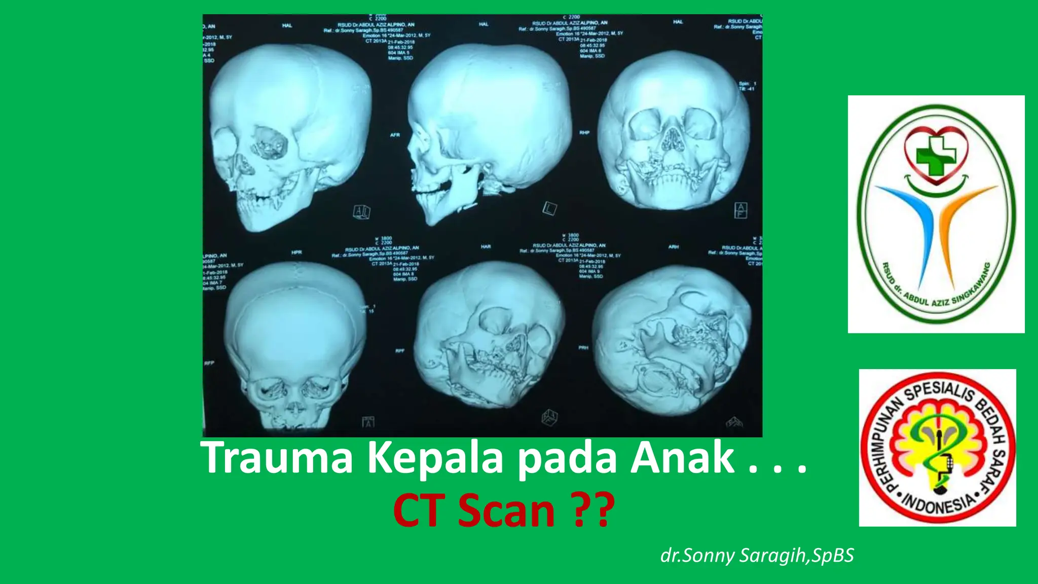 Pediatric Head Trauma Imaging - dr. Sonny G.R. Saragih Sp.BS.pptx