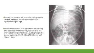 Pediatric High and Low intestinal Obstruction.pptx