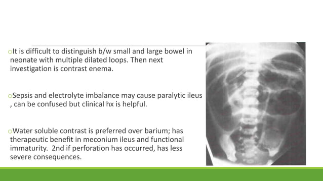 Pediatric High and Low intestinal Obstruction.pptx