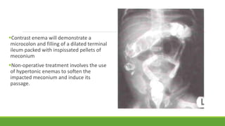 Pediatric High and Low intestinal Obstruction.pptx